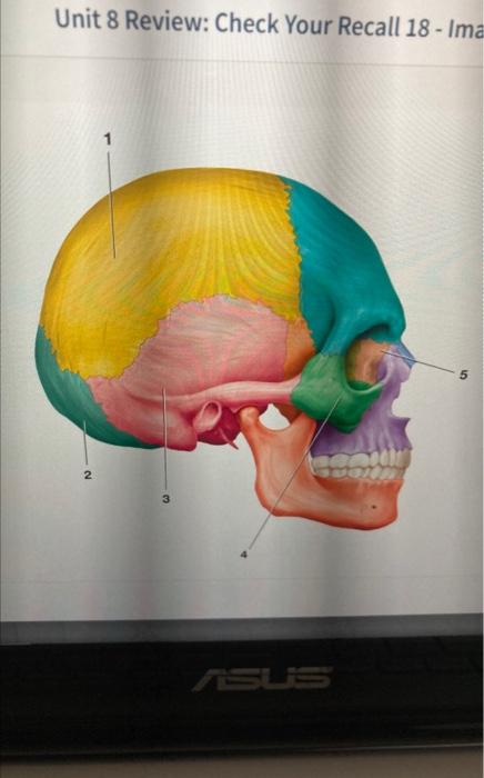 Solved Unit 8 Review: Check Your Recall 18 - Ima | Chegg.com