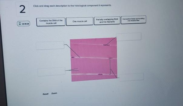 Solved Click and drag each description to the histological | Chegg.com