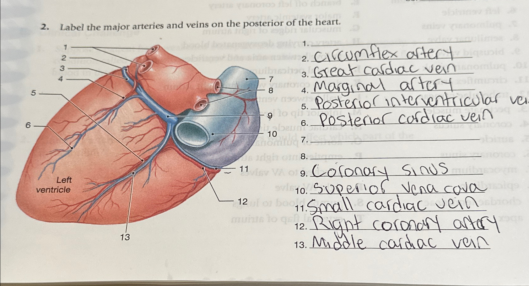 Solved Label the major arteries and veins on the posterior | Chegg.com