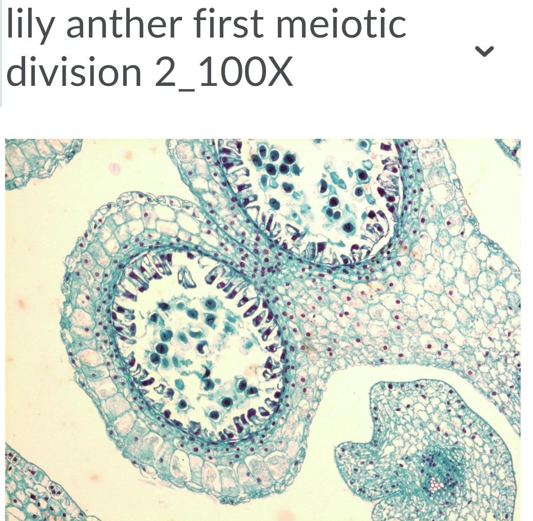 Solved lily anther second meiotic division_40X > lily | Chegg.com