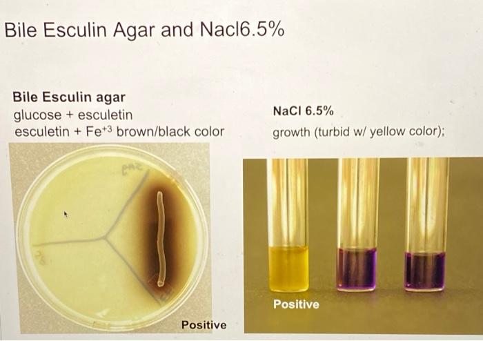 Salt Tolerance Test Principle, Procedure, Uses And, 40% OFF