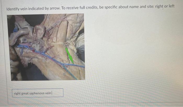 Solved Identify vein indicated by arrow Identify vein | Chegg.com