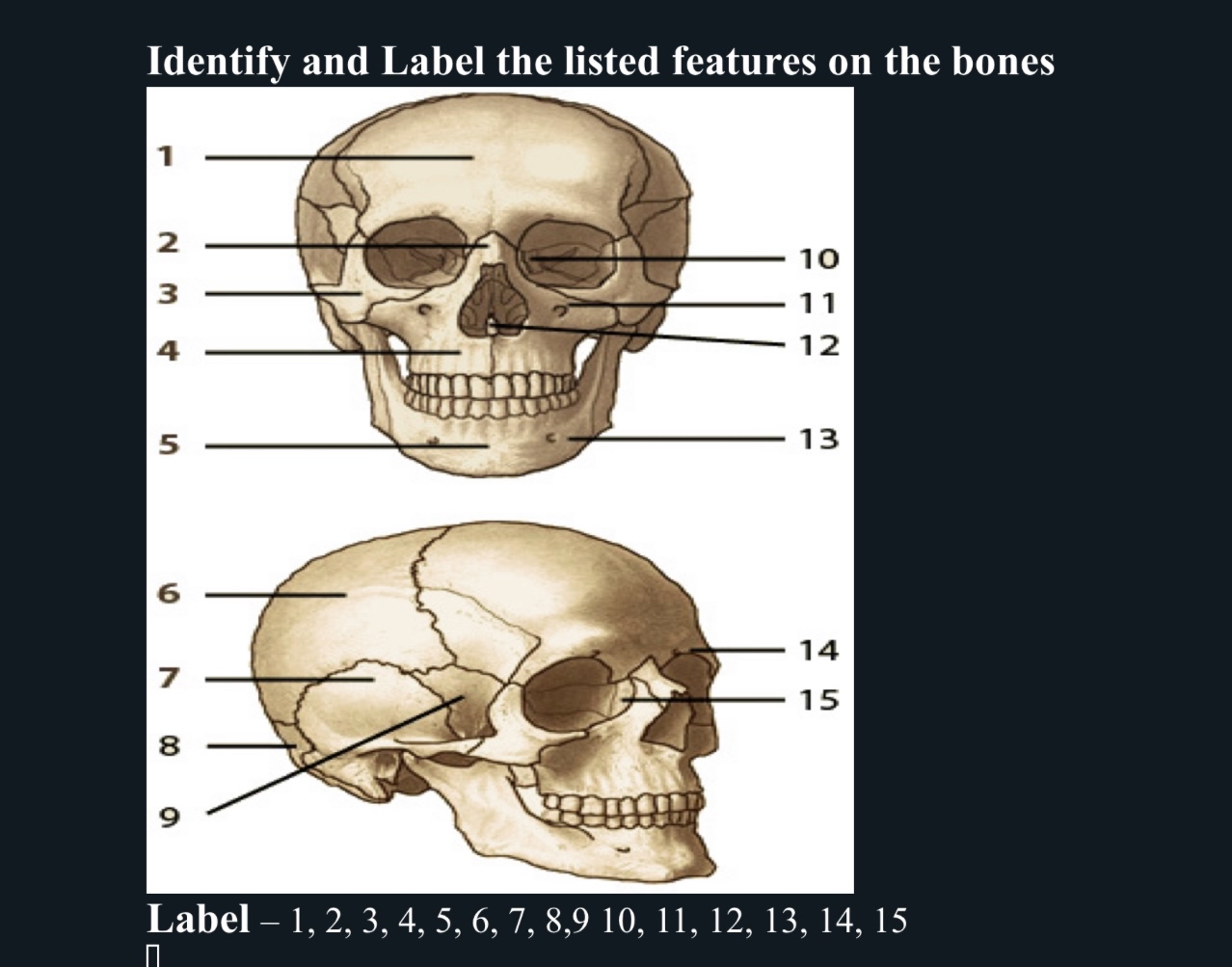 Solved Identify and Label the listed features on the | Chegg.com