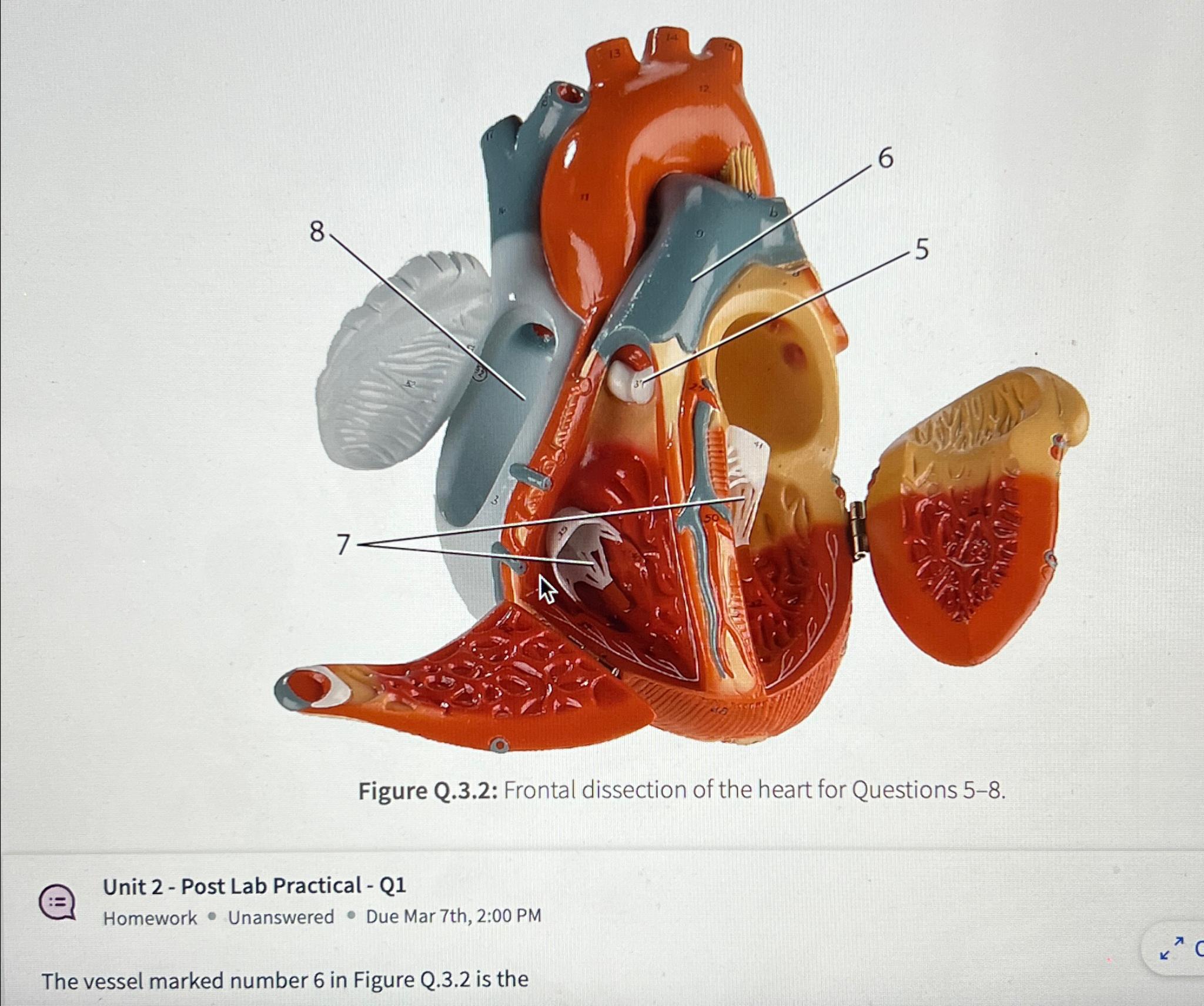 Solved Figure Q.3.2: Frontal dissection of the heart for | Chegg.com