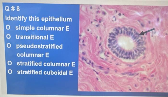Solved Q\# 8 Identify this epithelium 0 simple columnar O O | Chegg.com
