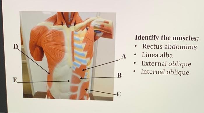 Solved Identify the muscles: - Rectus abdominis - Linea alba | Chegg.com