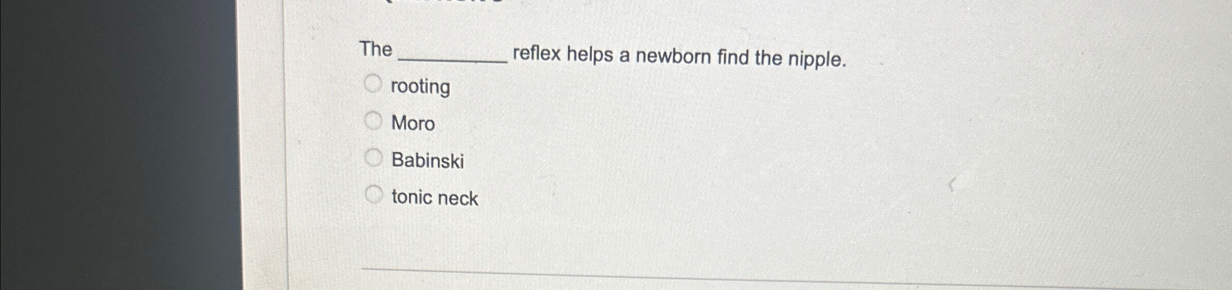 Solved The reflex helps a newborn find the | Chegg.com