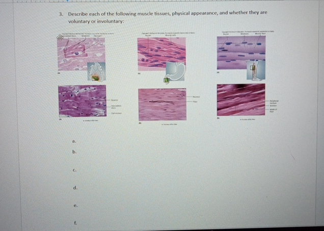 Solved Describe each of the following muscle tissues, | Chegg.com