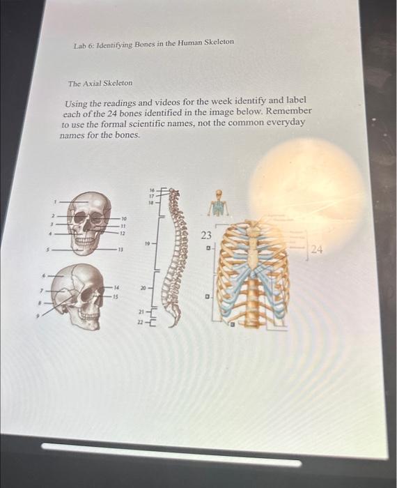 Lab 6: Identifying Bones in the Human Skeleton The | Chegg.com