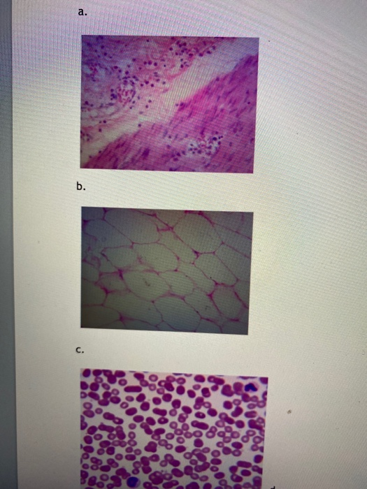 Connective Tissue Lab Activity 1. Identify each of | Chegg.com