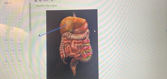 Solved Identify the organ Identify the organ (be | Chegg.com