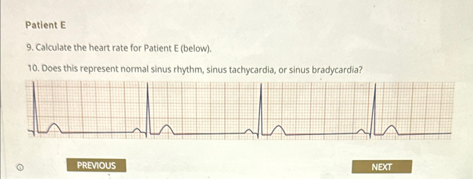 Patient E9. ﻿Calculate the heart rate for Patient | Chegg.com