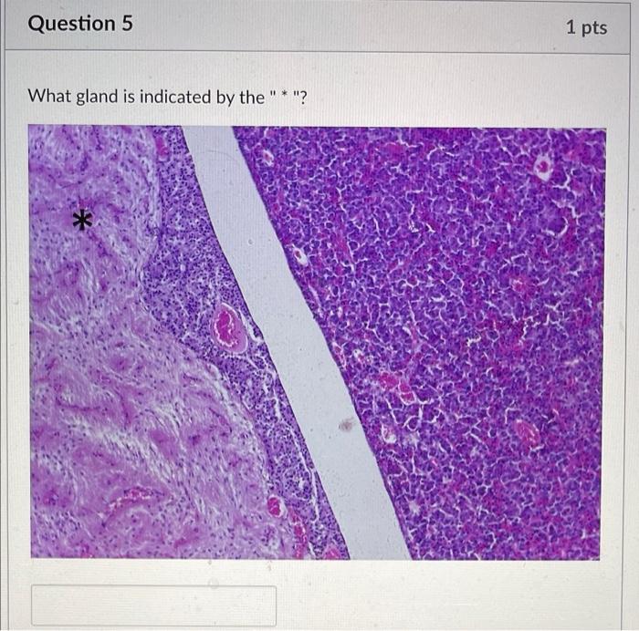 Solved Question 5 1 pts What gland is indicated by the "* "? | Chegg.com