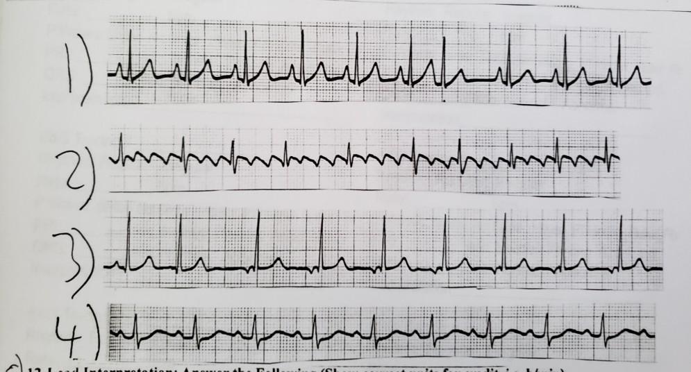 Solved Rhythm: Regular Irregular Rate: bpm P Waves: Similar | Chegg.com