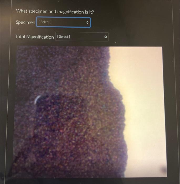 Solved What specimen and magnification is it? Specimen Total | Chegg.com