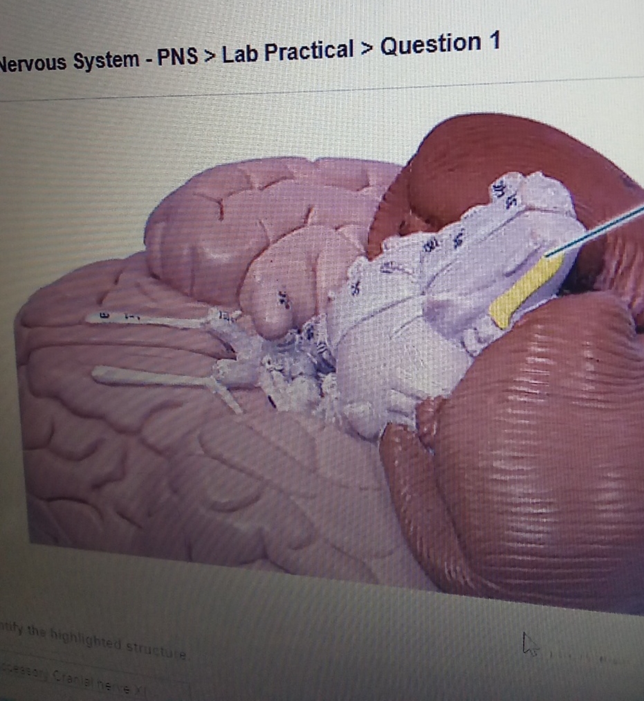 Nervous System - ﻿PNS > ﻿Lab Practical > ﻿Question 1 | Chegg.com