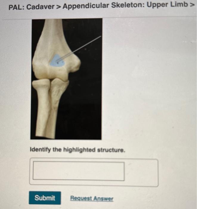 Solved PAL: Cadaver > Appendicular Skeleton: Upper Limb > | Chegg.com
