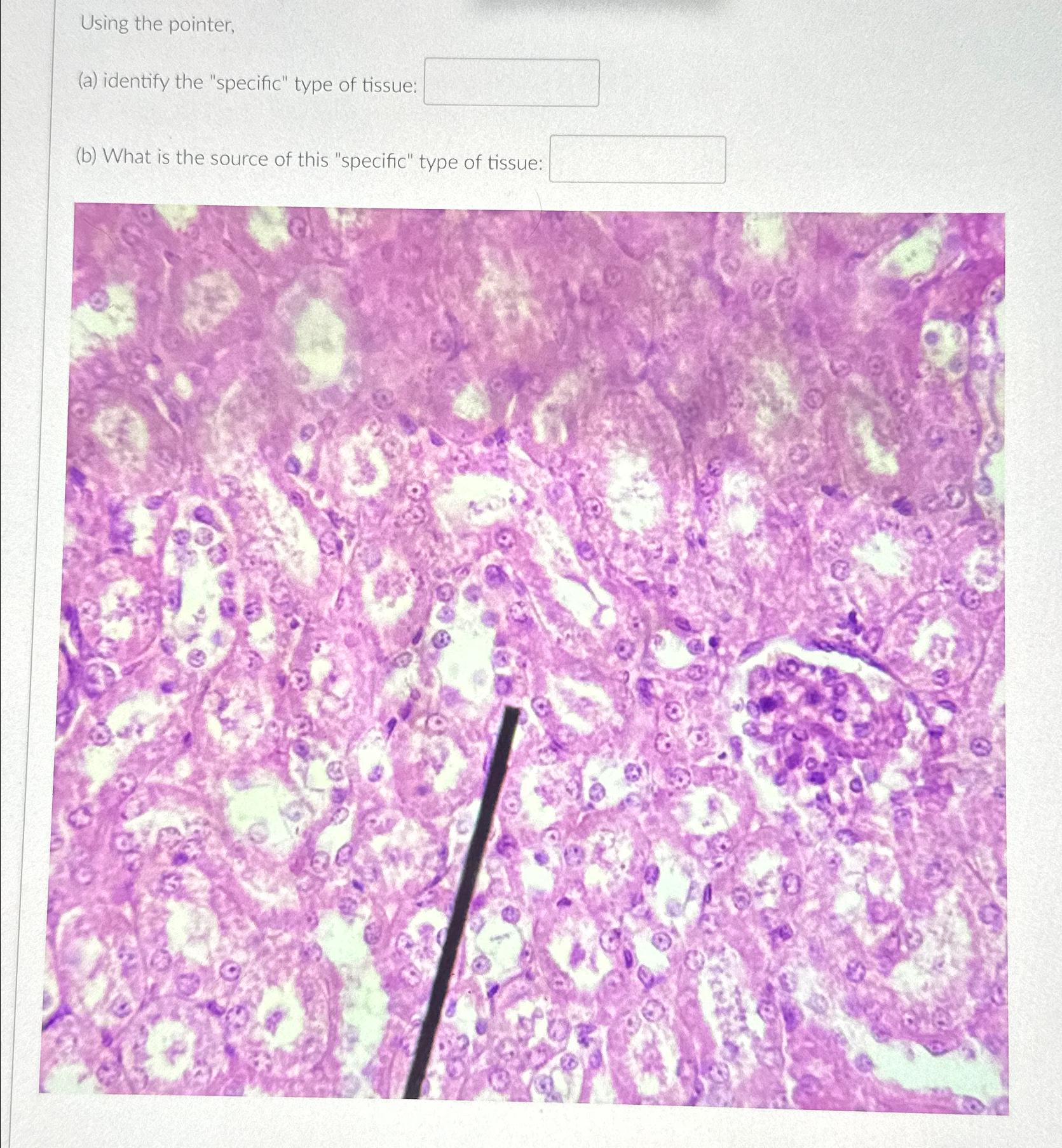 Solved Using the pointer,(a) ﻿identify the "specific" type | Chegg.com