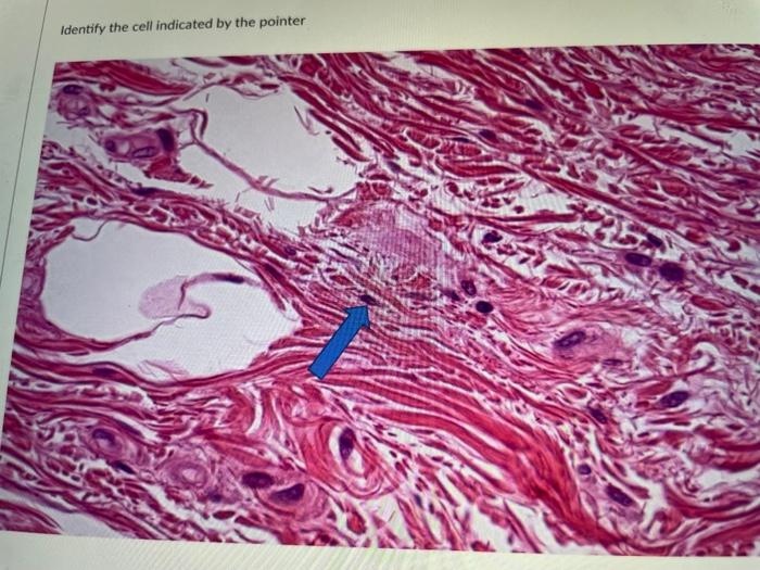 Solved Identify the tissue indicated by the pointer | Chegg.com