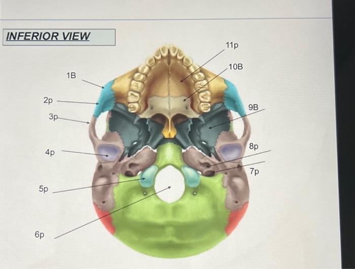 Solved INFERIOR VIEW | Chegg.com