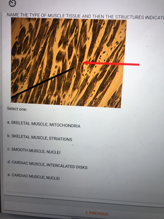 Solved NAME THE TYPE OF MUSCLE TISSUE AND THEN THE | Chegg.com