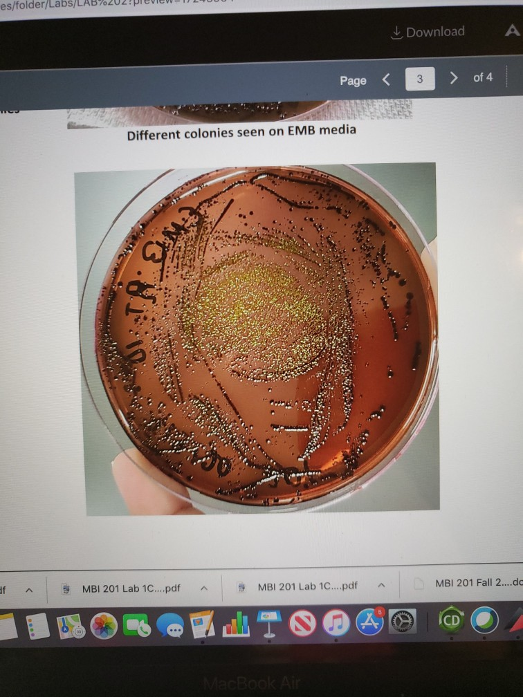 Solved EMB RESULTS: Pink colonies Dark purple colonies | Chegg.com