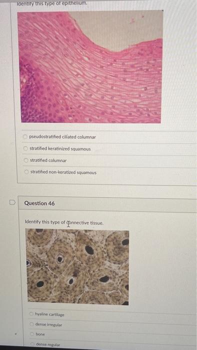 Solved Identify the epithelium. stratified cuboidal simple | Chegg.com