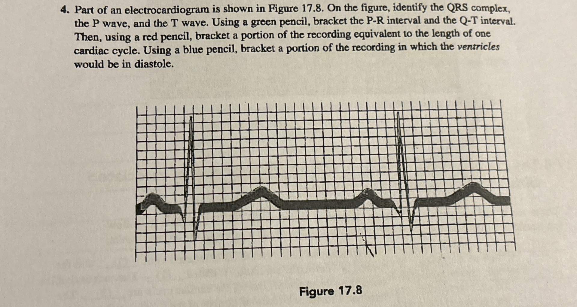 Solved Part of an electrocardiogram is shown in Figure 17.8. | Chegg.com