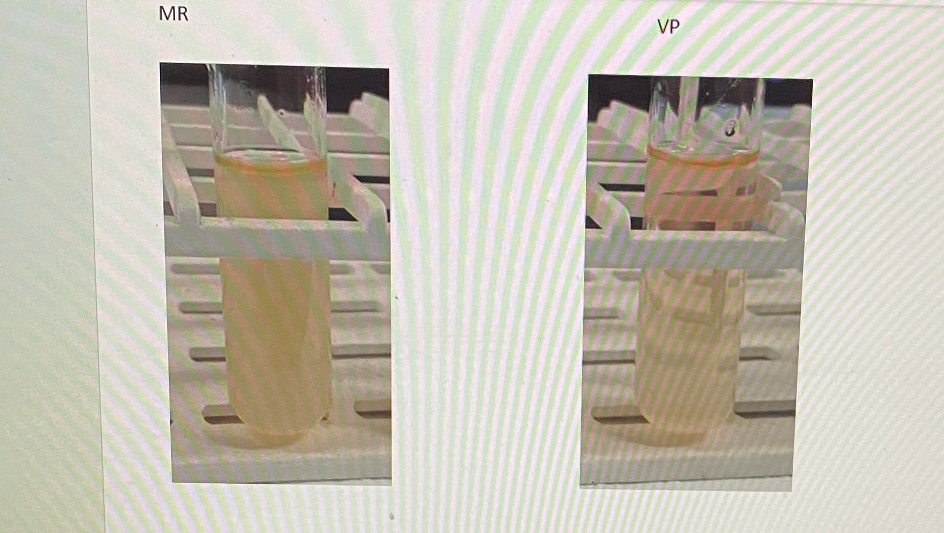 Solved What is the bacteria and a detailed lab report? | Chegg.com