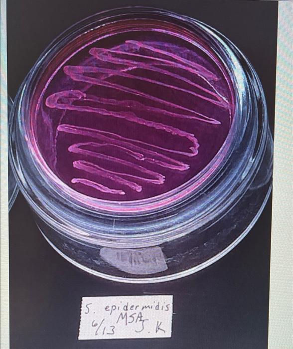 Solved 5. epidermidis 6/3 MSAK S. epidermidis 6/13 MSAK | Chegg.com