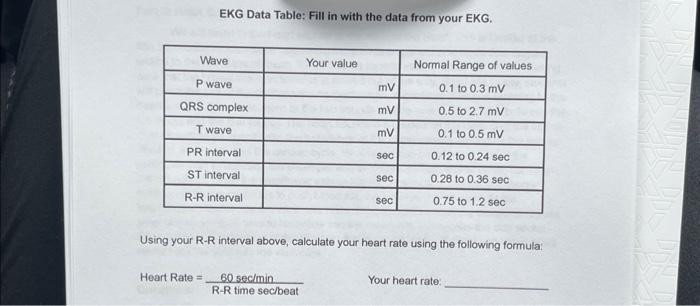 Solved EKG Data Table: Fill in with the data from your EKG. | Chegg.com
