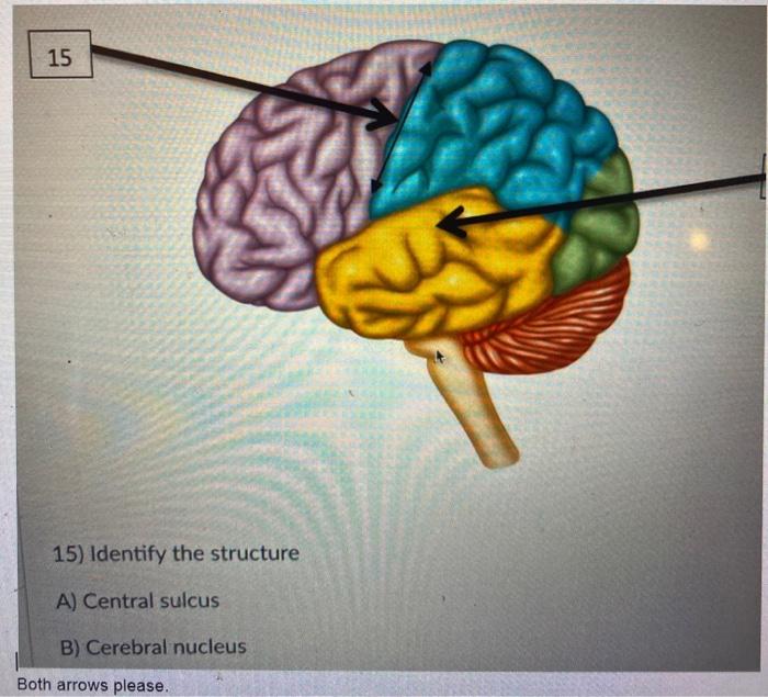 Solved 15 15) Identify the structure A) Central sulcus B) | Chegg.com