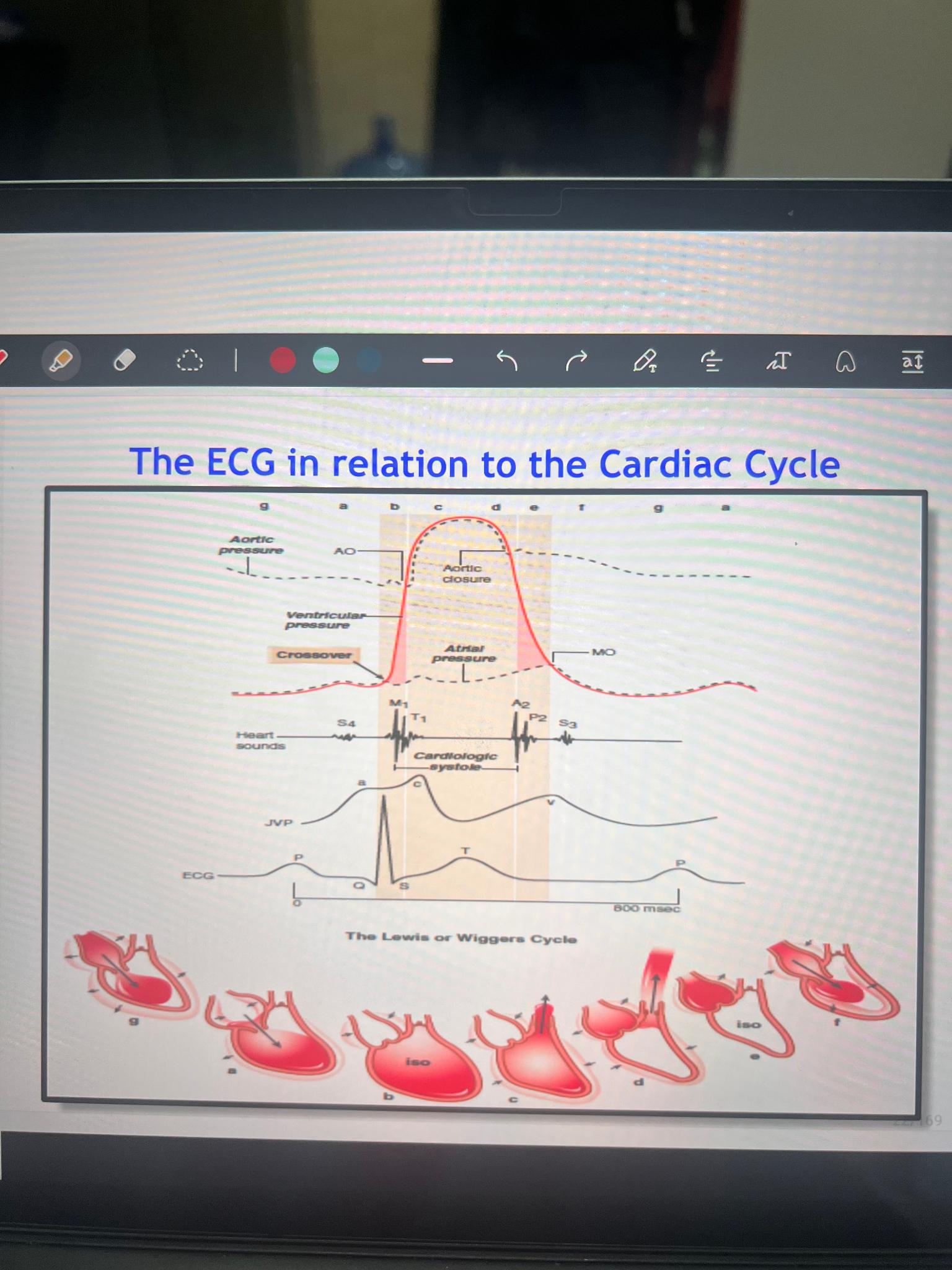 Solved Explain this:The ECG in relation to the Cardiac Cycle | Chegg.com