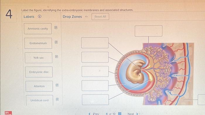 4 Label the figure, identifying the extra embryonic | Chegg.com