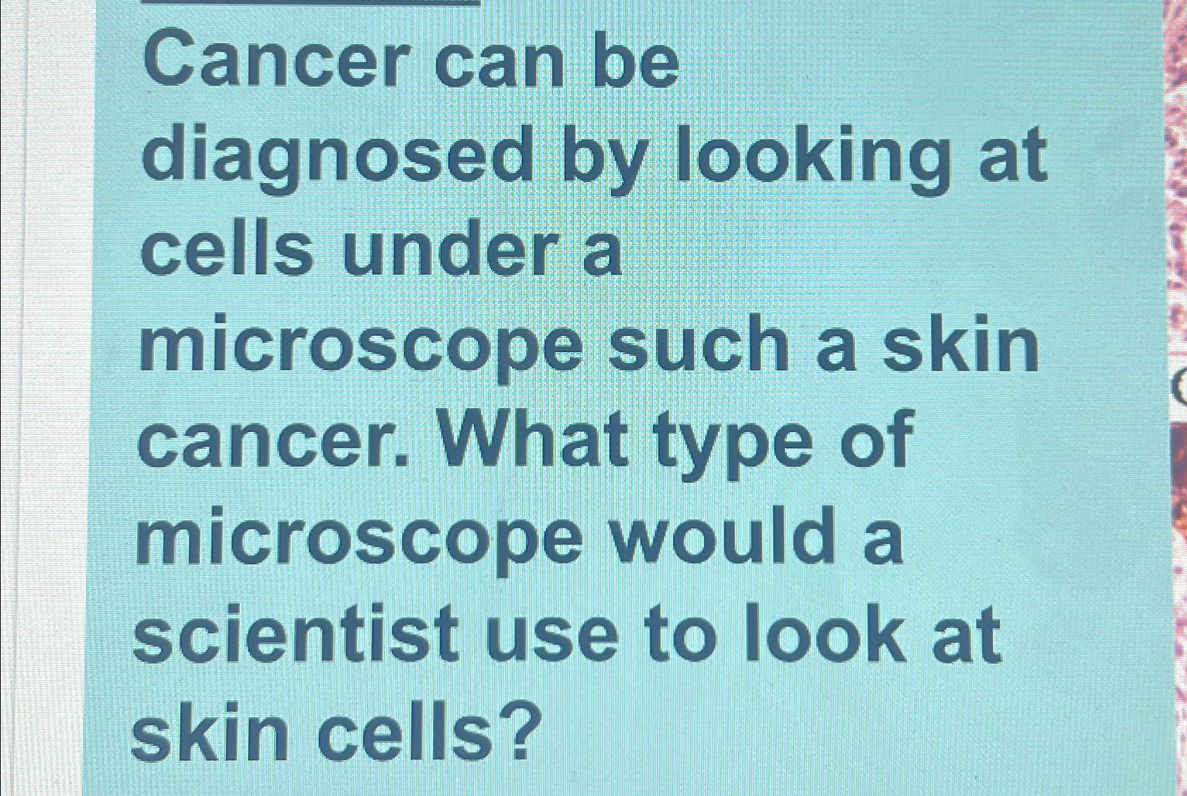 Solved Cancer can be diagnosed by looking at cells under a | Chegg.com