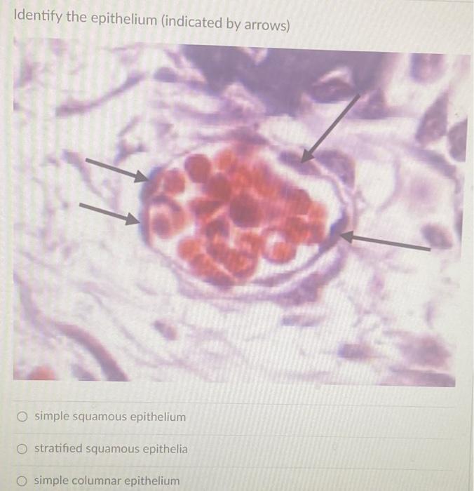 Solved Identify the epithelial tissue in the indicated area | Chegg.com