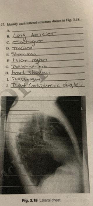 27. Identify each lettered structure shown in Fig. | Chegg.com
