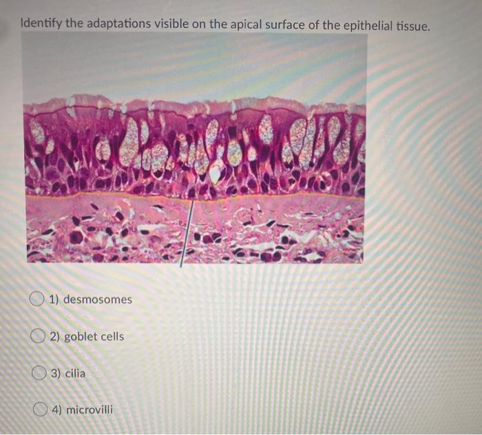 Solved Identify the adaptations visible on the apical | Chegg.com