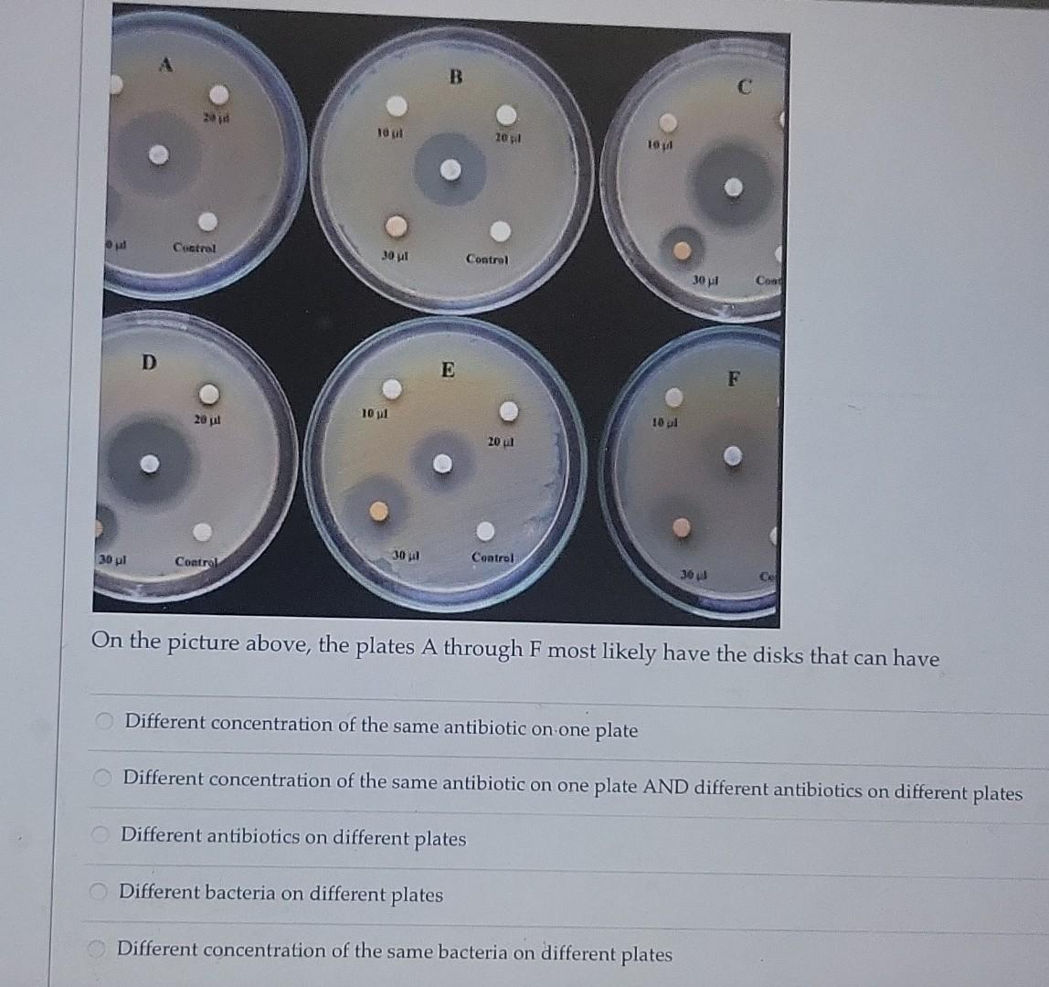 Solved The plate on the picture is inoculated using plating | Chegg.com