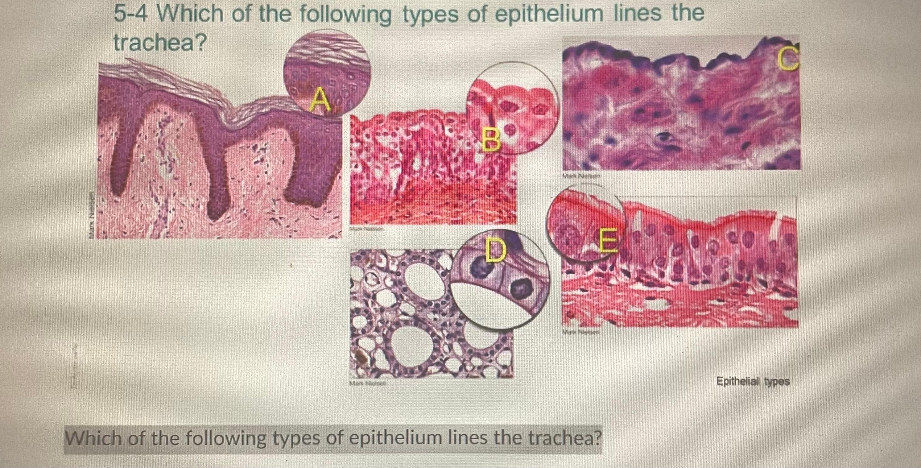 Which of the following types of epithelium lines the | Chegg.com