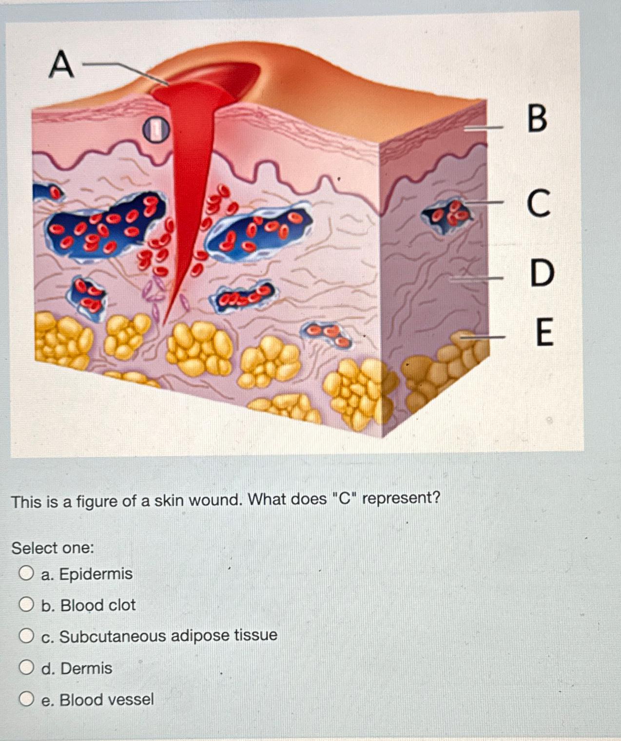 Solved This is a figure of a skin wound. What does "C" | Chegg.com