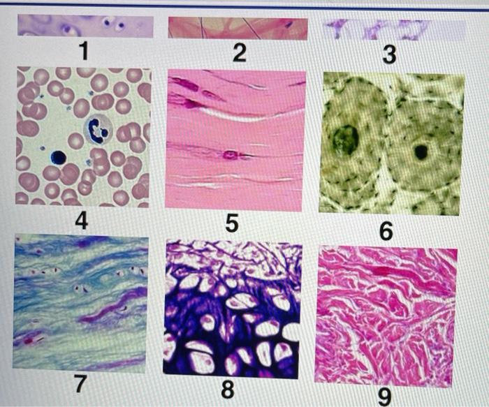 please label the type of connective tissue! I | Chegg.com