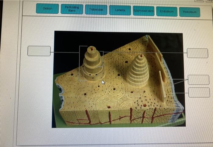 Solved Ontoon Perforating fibers Traboca Lamello Epiphyl | Chegg.com