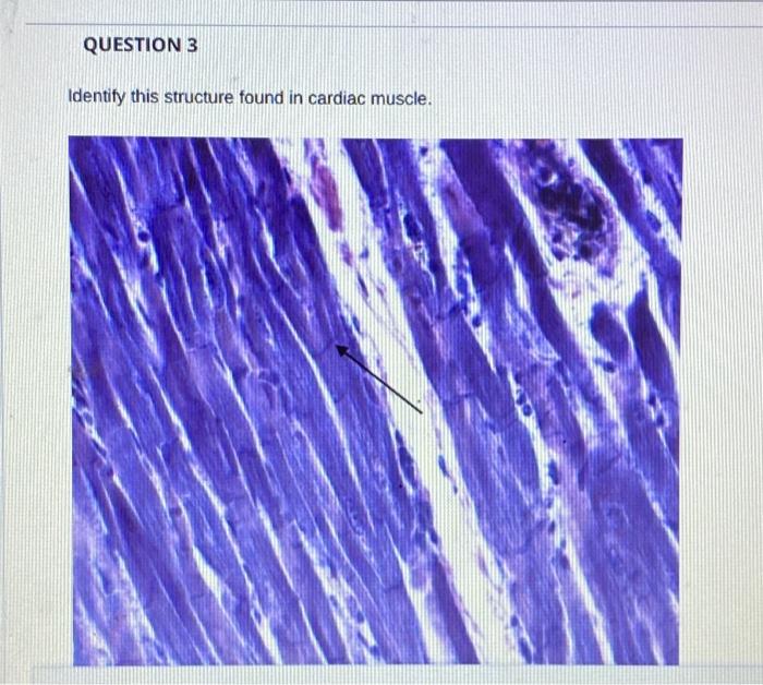 Solved 1.identify the type of muscle found within this | Chegg.com Solved 1.identify the type of muscle found within this | Chegg.com