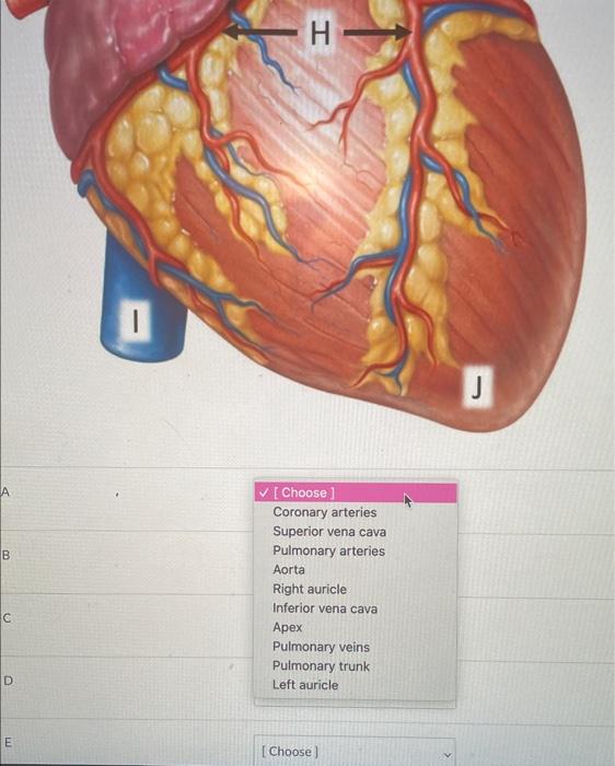 Solved [Choose] Coronary arteries Superior vena cava | Chegg.com