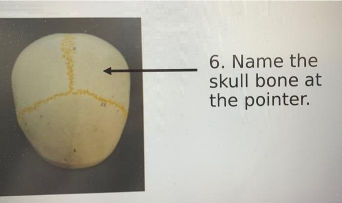 Solved 6. Name the skull bone at the pointer. | Chegg.com