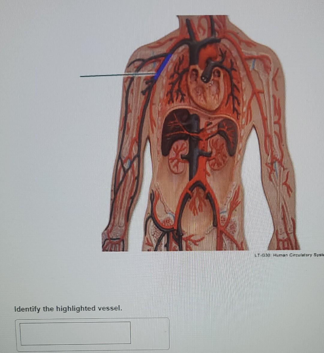 [Solved]: Identify the highlighted vessel.