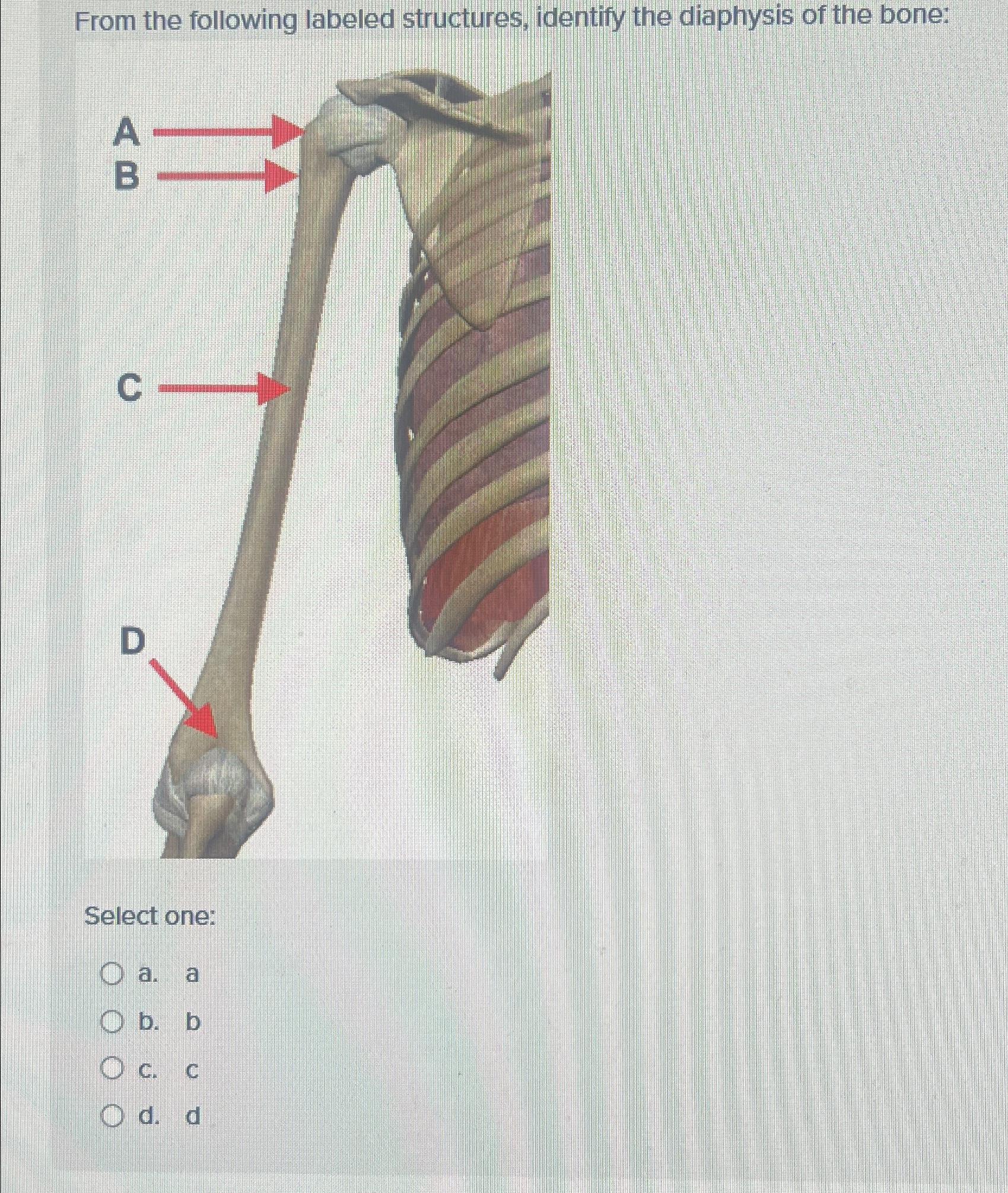 Solved From the following labeled structures, identify the | Chegg.com