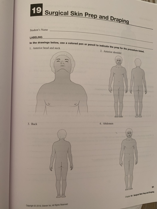 Solved Surgical Skin Prep and Draping In the drawings below, | Chegg.com