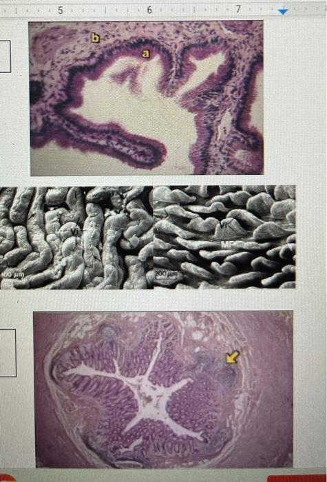 Solved What structure is pictured? What mucosa is the arrow | Chegg.com